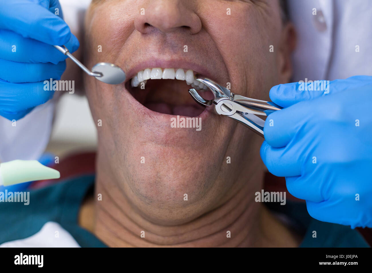 Dentist woman extraction hi-res stock photography and images - Alamy