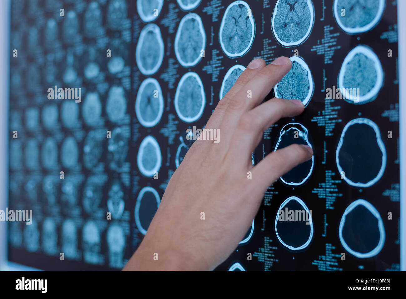 Hand ct scan High Resolution Stock Photography and Images - Alamy