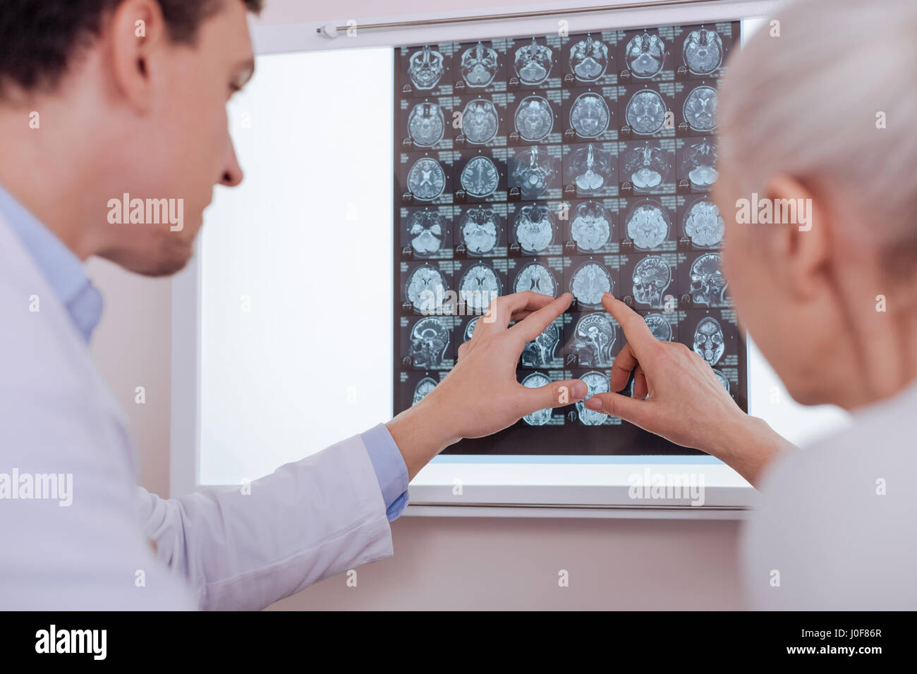 Nice aged woman pointing at the brain X ray image Stock Photo - Alamy