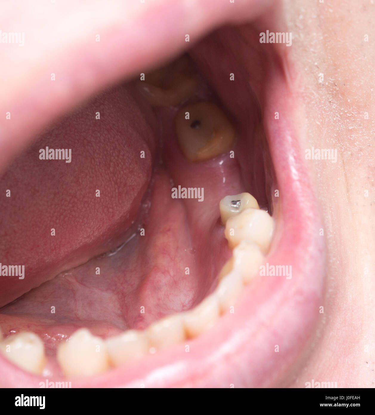 Toothless man smiling hi-res stock photography and images - Alamy