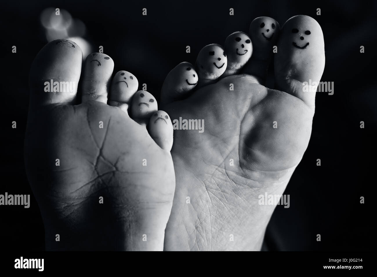 Bruised Toenail High Resolution Stock Photography and Images - Alamy