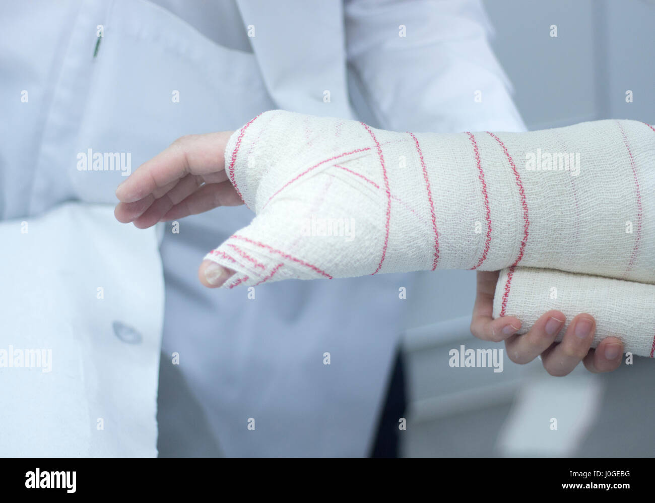 Doctor applying a plaster cast and bandages to patient forearm and ...