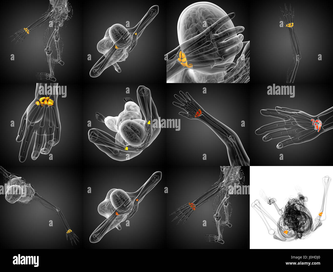 3d rendering illustration of the human carpal bones Stock Photo - Alamy