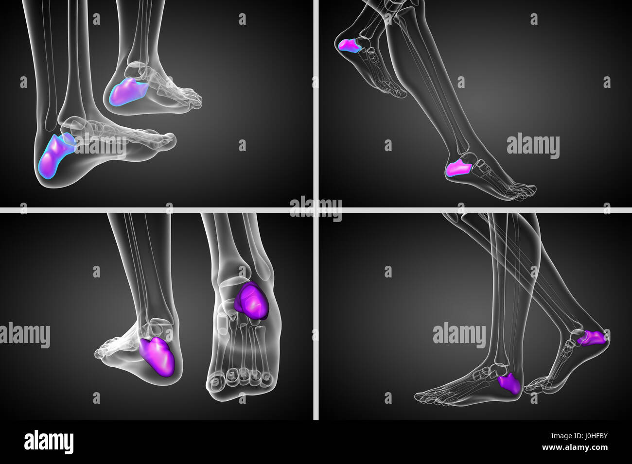3d rendering medical illustration of the calcaneus bone Stock Photo - Alamy