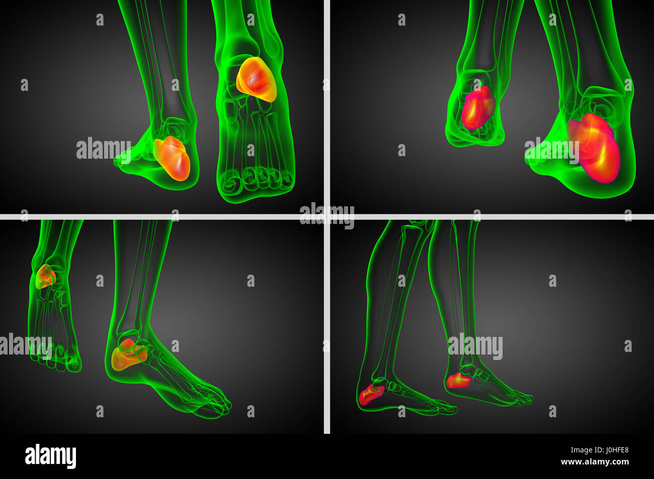 3d rendering medical illustration of the calcaneus bone Stock Photo - Alamy