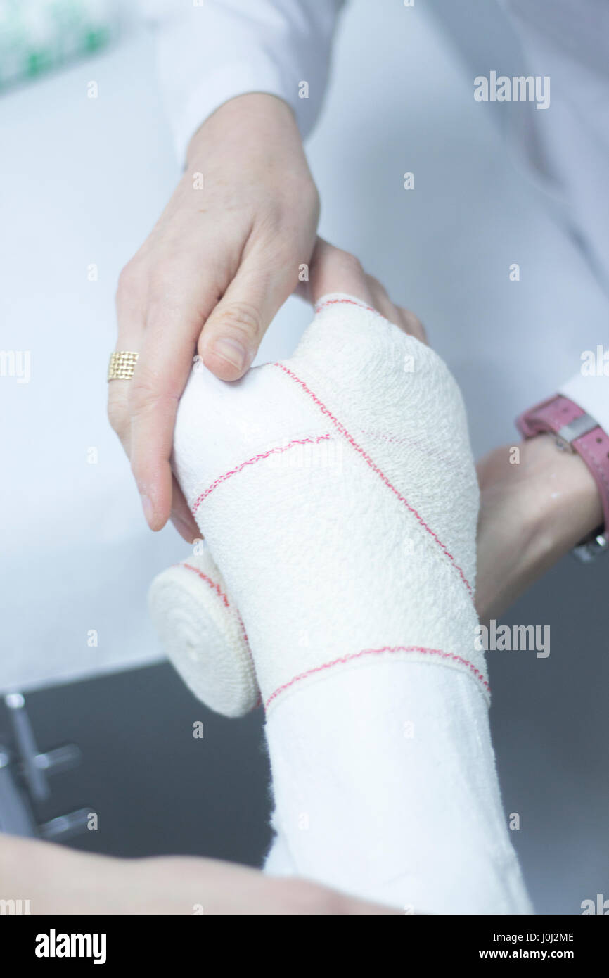 Doctor applying a plaster cast and bandages to patient forearm and ...