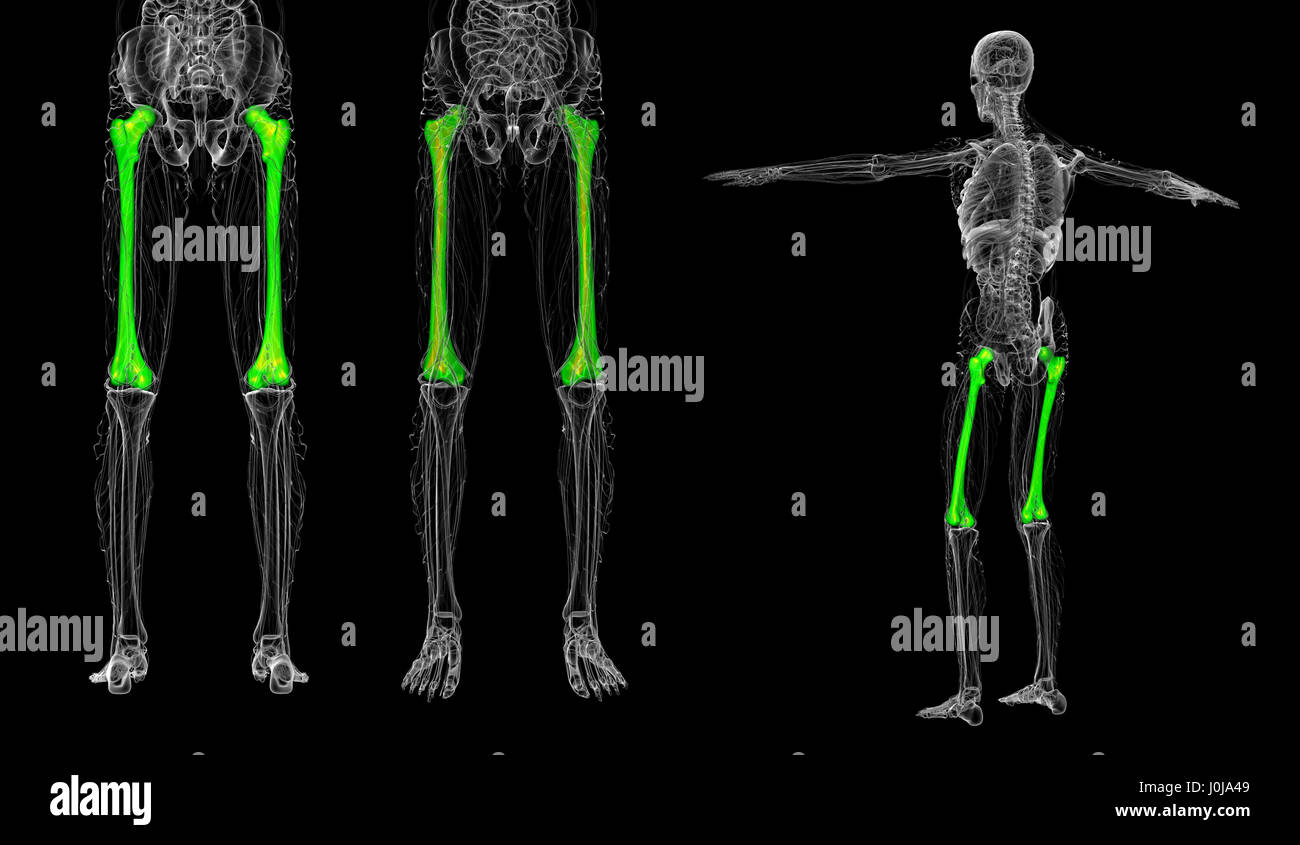 3d rendering medical illustration of the femur bone Stock Photo - Alamy