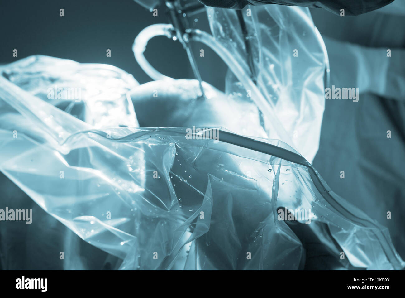 Knee keyhole surgery hospital arthroscopy operation medical procedure ...