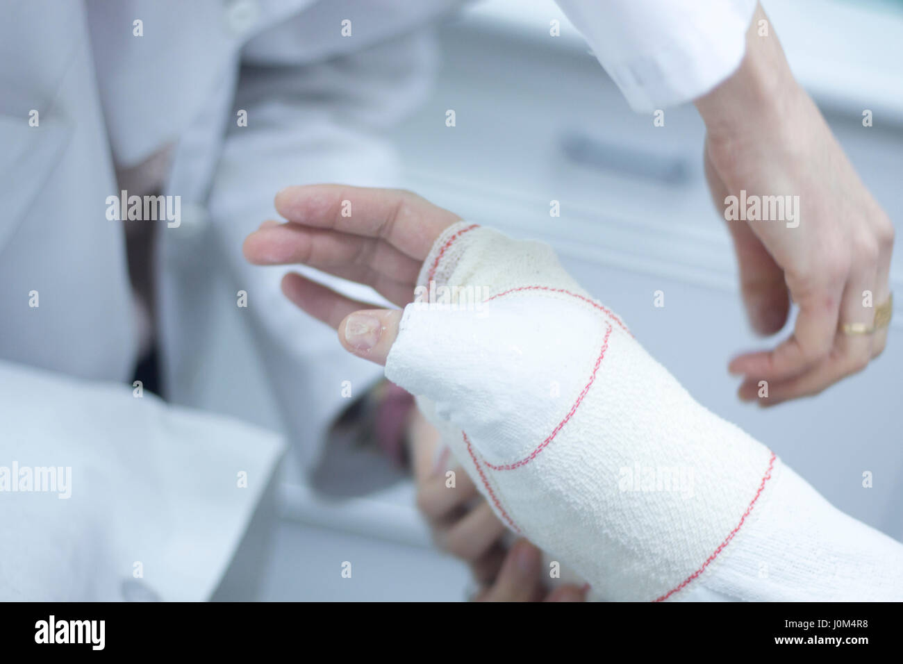 Doctor applying a plaster cast and bandages to patient forearm and ...