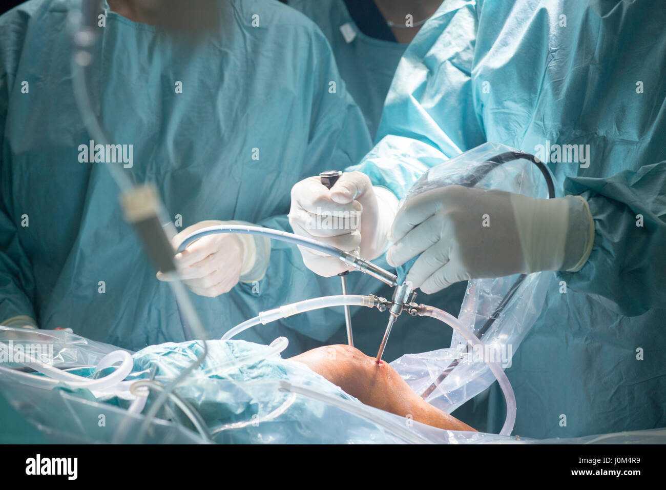 Knee keyhole surgery hospital arthroscopy operation medical procedure ...