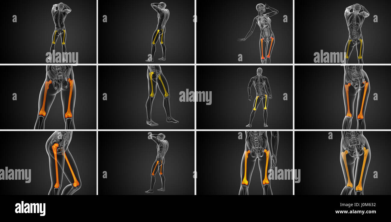 3d rendering medical illustration of the femur bone Stock Photo - Alamy