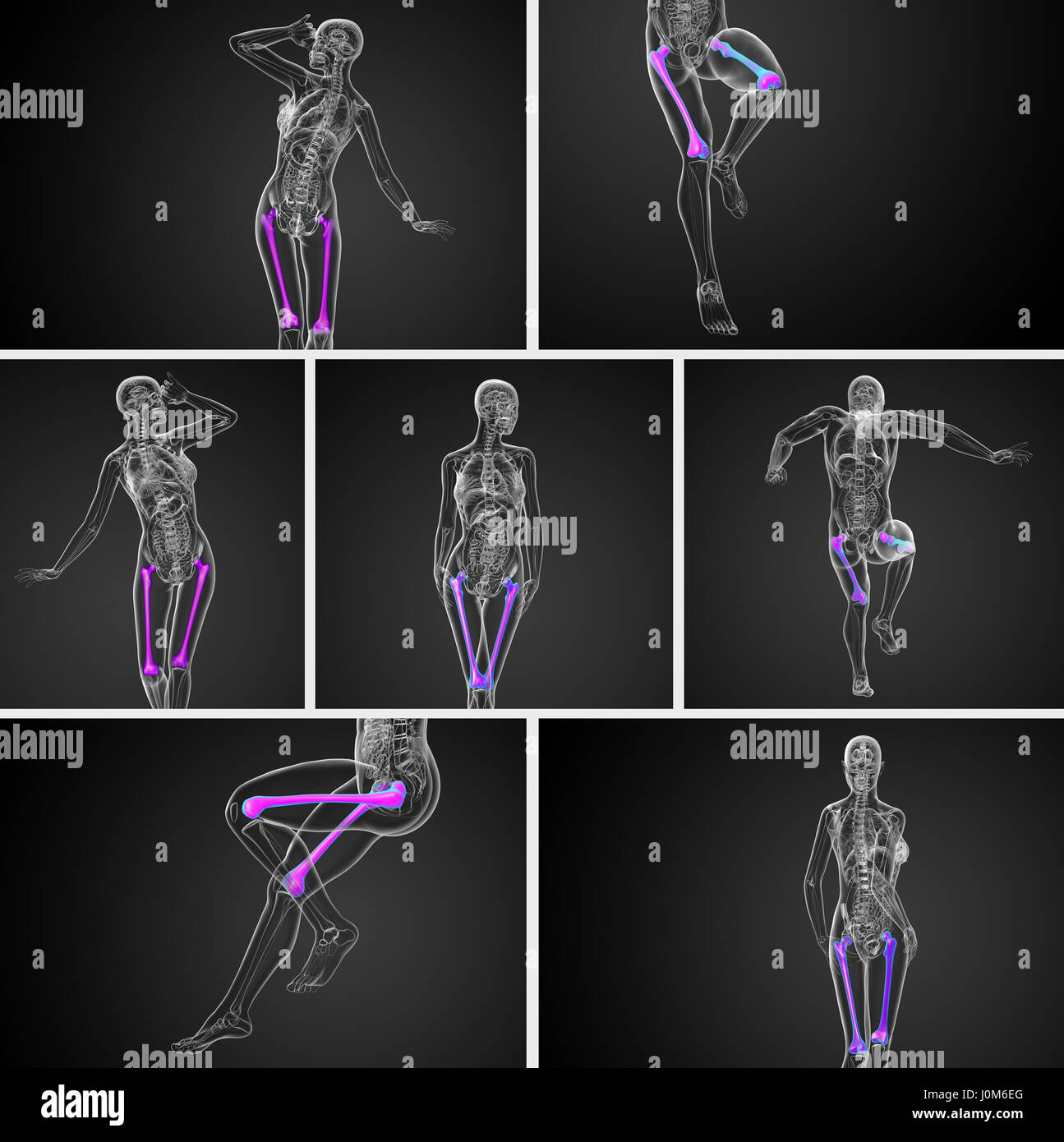 3d rendering medical illustration of the femur bone Stock Photo - Alamy