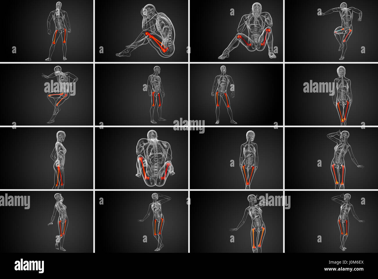 3d rendering medical illustration of the femur bone Stock Photo - Alamy