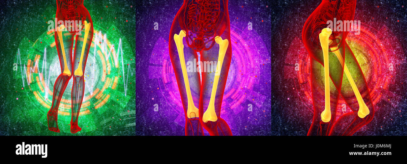3d rendering medical illustration of the femur bone Stock Photo - Alamy