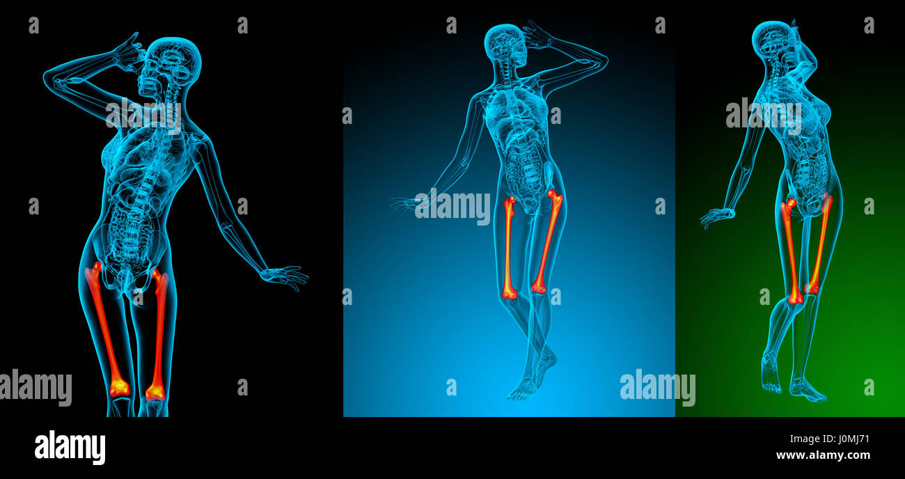 3d rendering medical illustration of the femur bone Stock Photo - Alamy