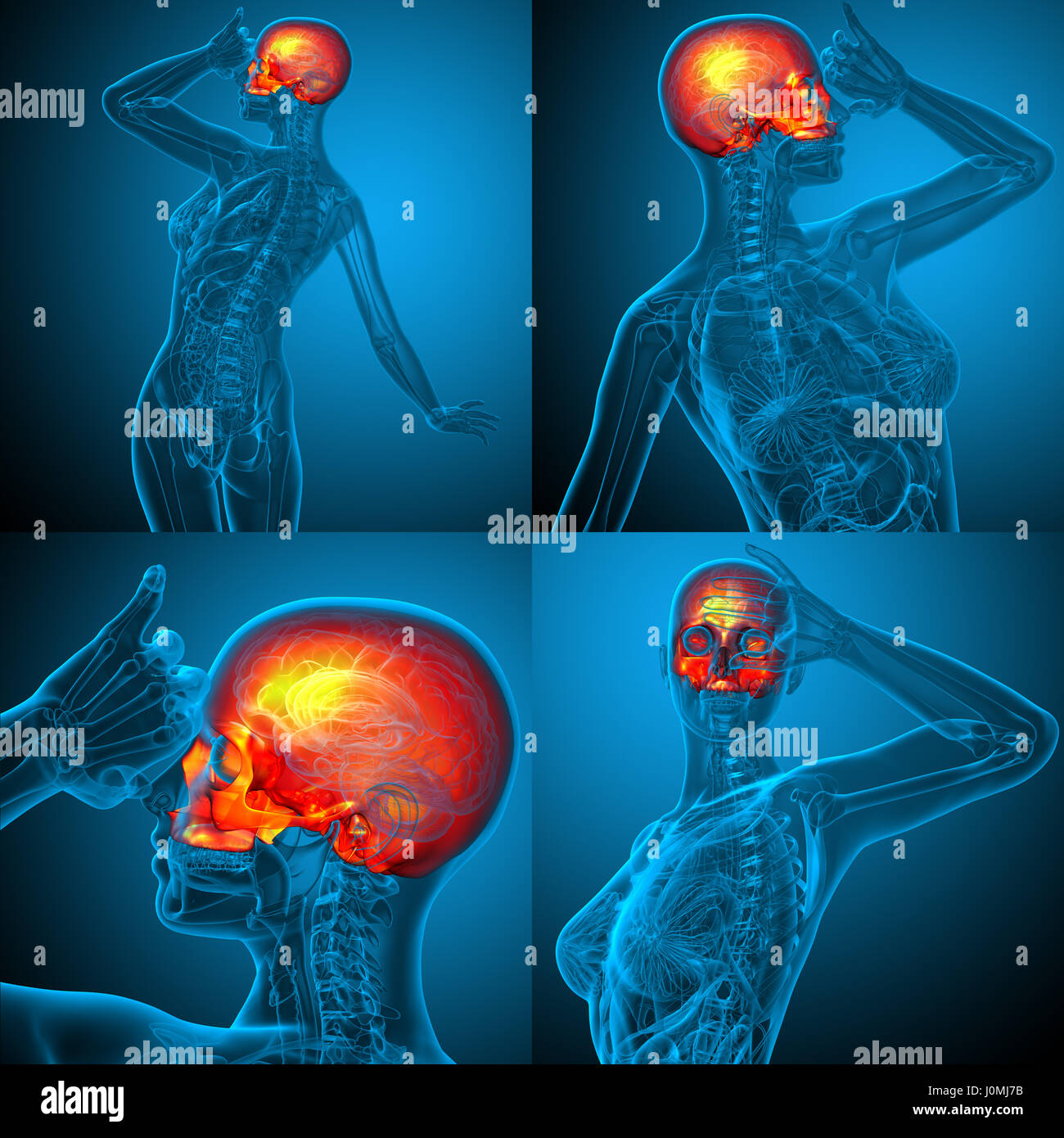 3d rendering medical illustration of the upper skull Stock Photo - Alamy
