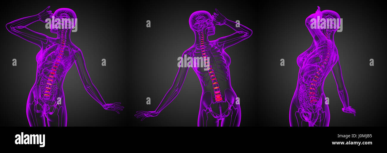 Spinal disc 3d hi-res stock photography and images - Alamy