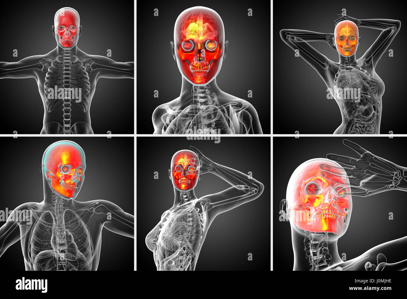 3d rendering medical illustration of the skull Stock Photo - Alamy