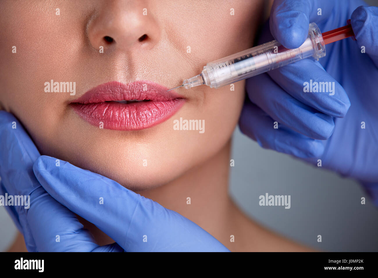 Treatment with botox hyaluronic collagen injection Stock Photo - Alamy
