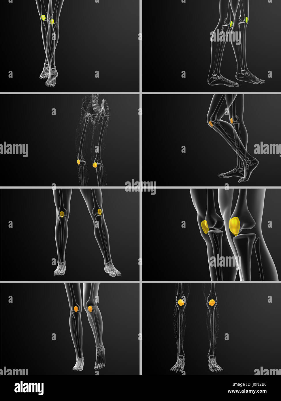 3d rendering medical illustration of the patella bone Stock Photo - Alamy
