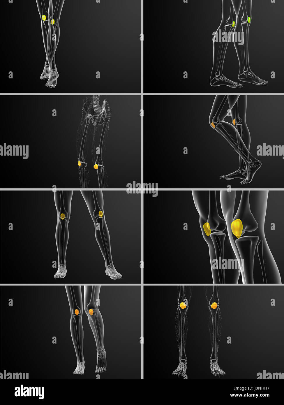 3d rendering medical illustration of the patella bone Stock Photo - Alamy