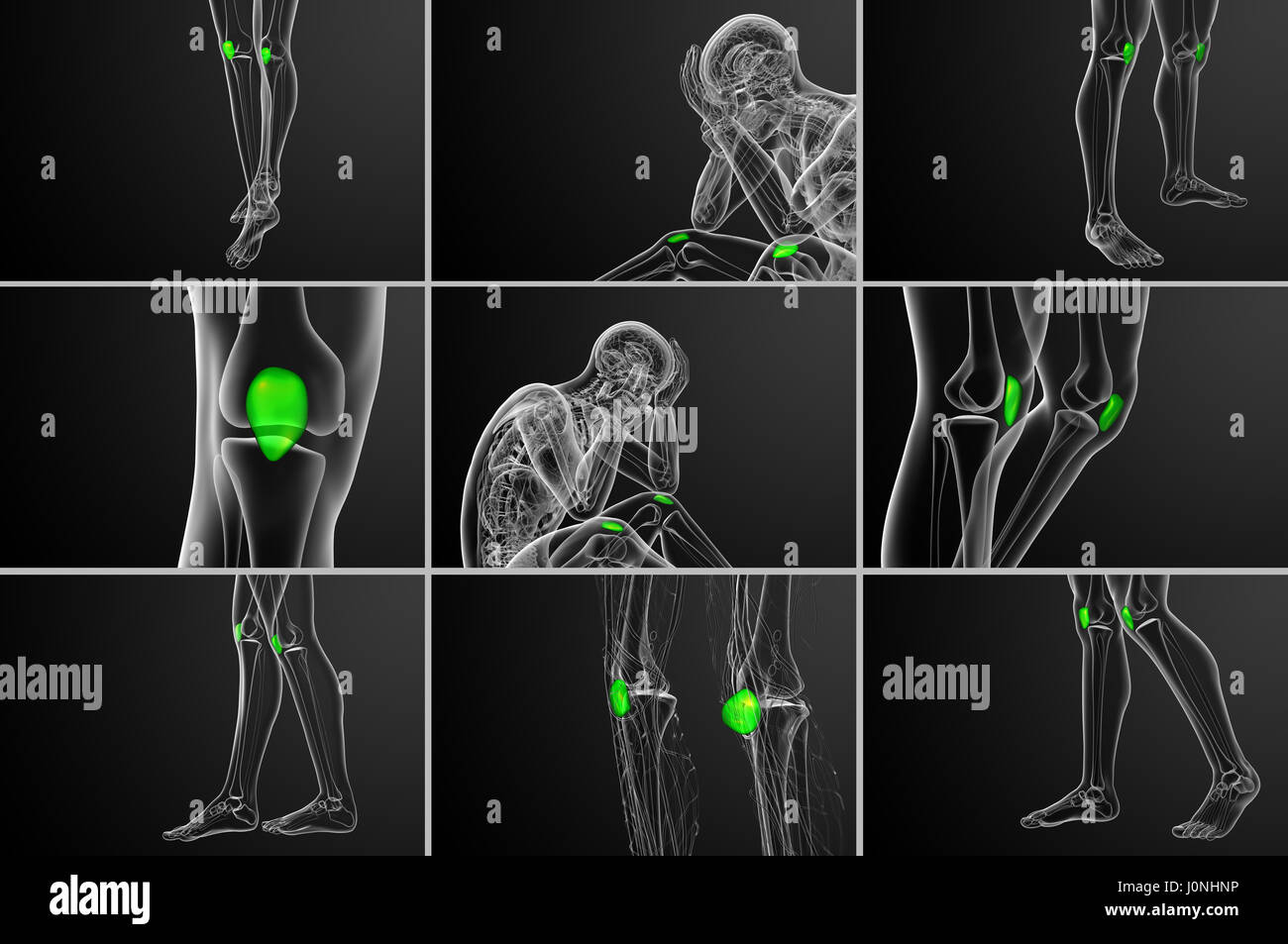 3d rendering medical illustration of the patella bone Stock Photo - Alamy