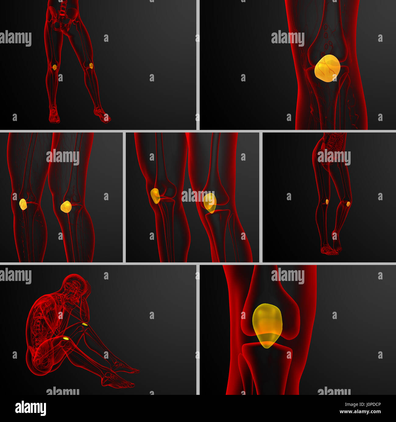 3d rendering medical illustration of the patella bone Stock Photo - Alamy