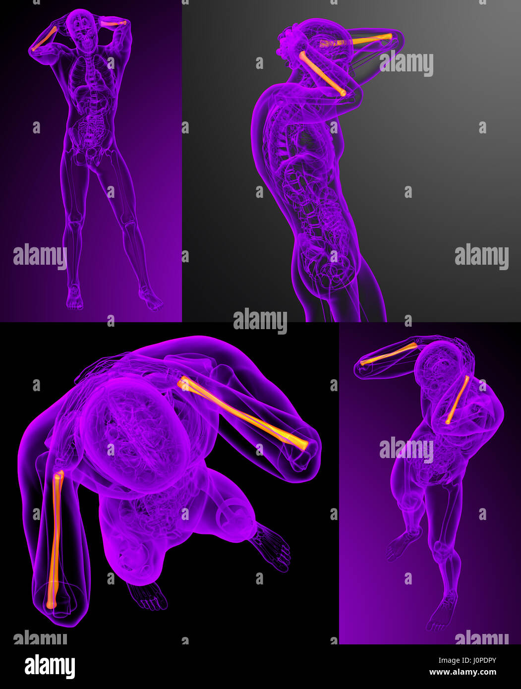 3d rendering medical illustration of the radius bone Stock Photo - Alamy