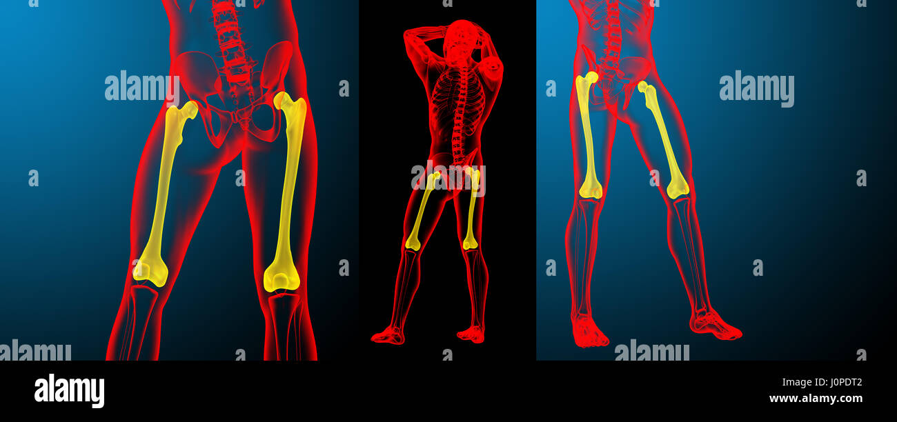 3d rendering medical illustration of the femur bone Stock Photo - Alamy