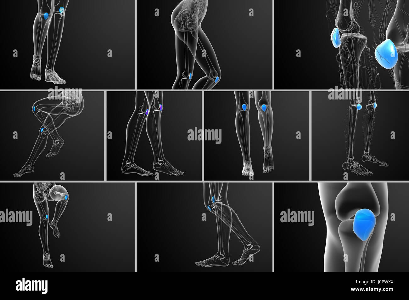 3d rendering medical illustration of the patella bone Stock Photo - Alamy