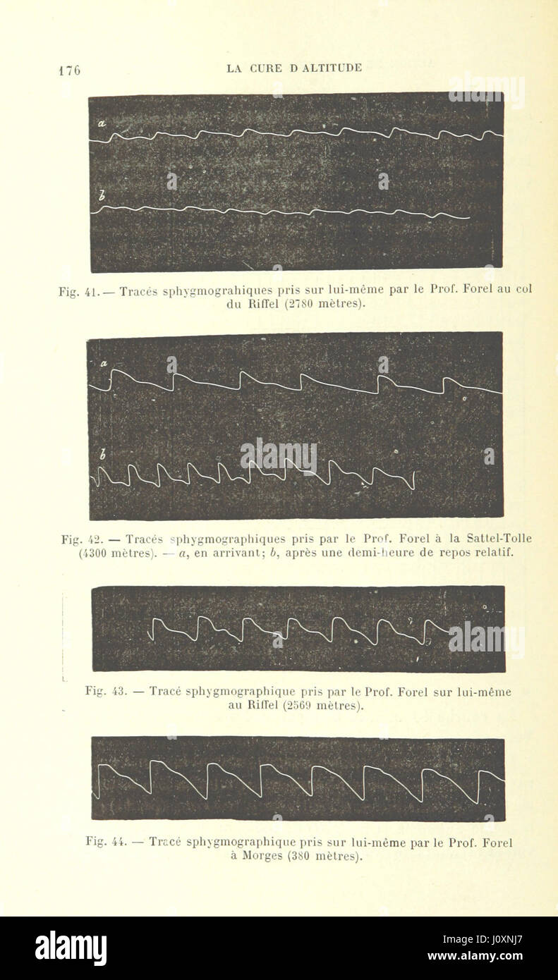 This work explores altitude therapy and its effects on health, with ...