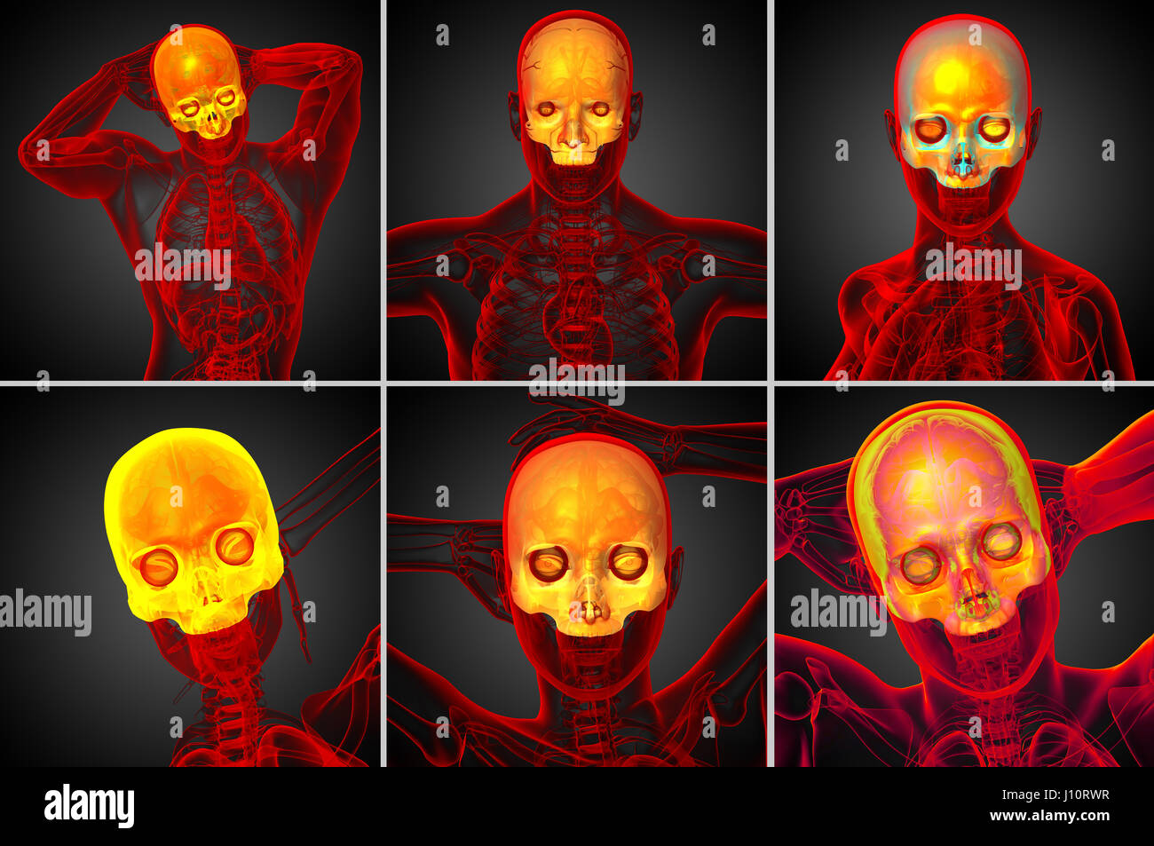 3d rendering medical illustration of the upper skull Stock Photo - Alamy