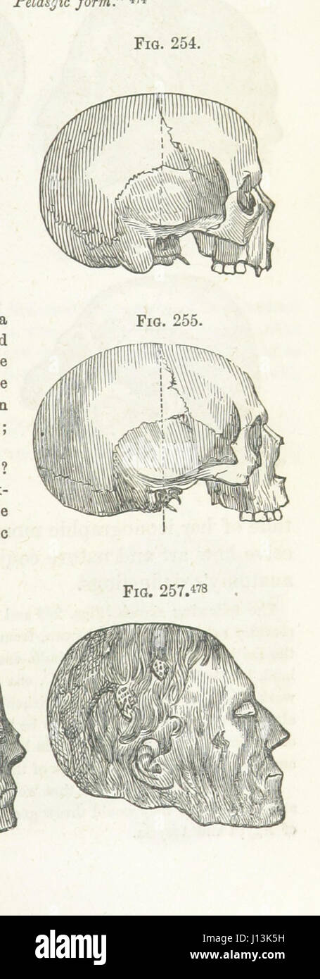 Nott gliddon hi-res stock photography and images - Alamy