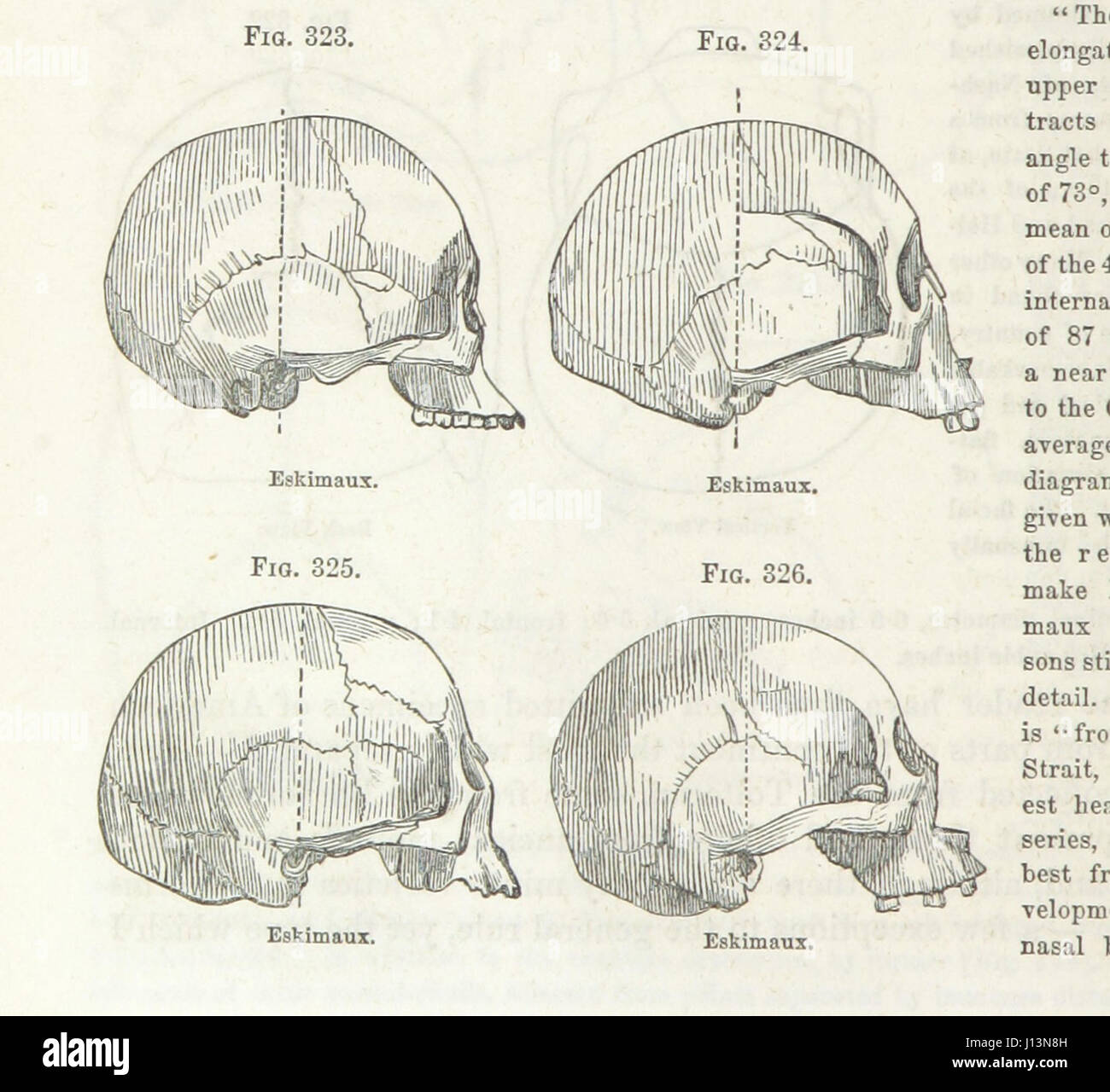 [Types of Mankind: or Ethnological Researches ... illustrated by ...
