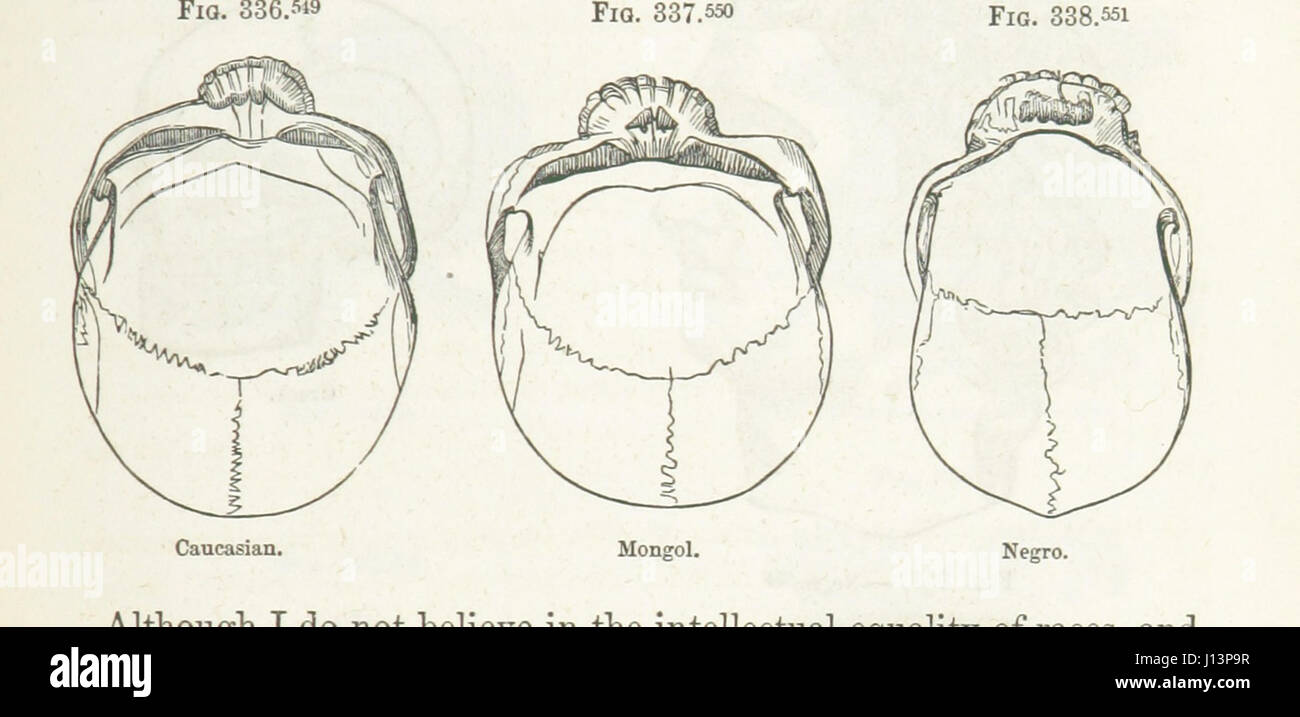 [Types of Mankind: or Ethnological Researches ... illustrated by ...