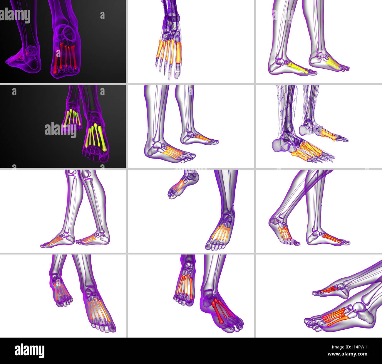 3d rendering medical illustration of the metatarsal bones Stock Photo ...