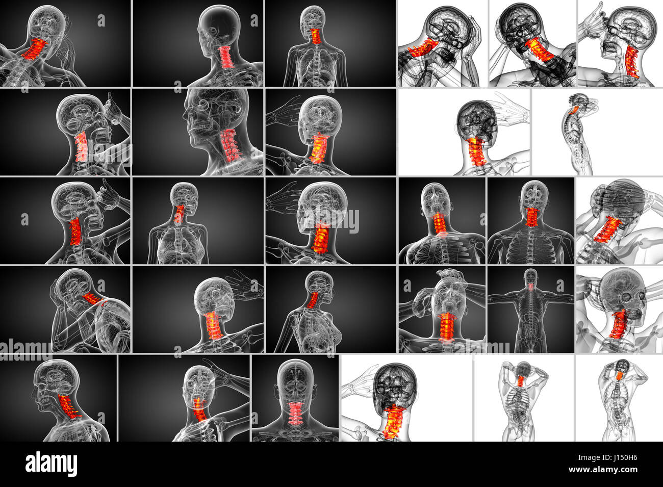 3d rendering medical illustration of the cervical spine Stock Photo - Alamy