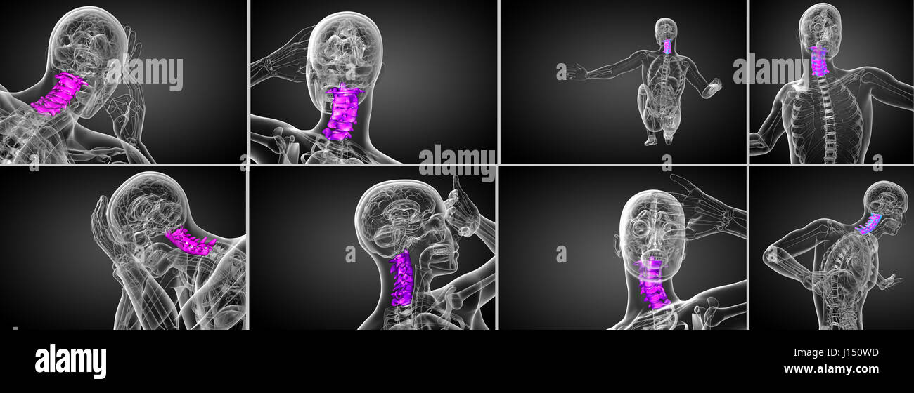 3d rendering medical illustration of the cervical spine Stock Photo - Alamy