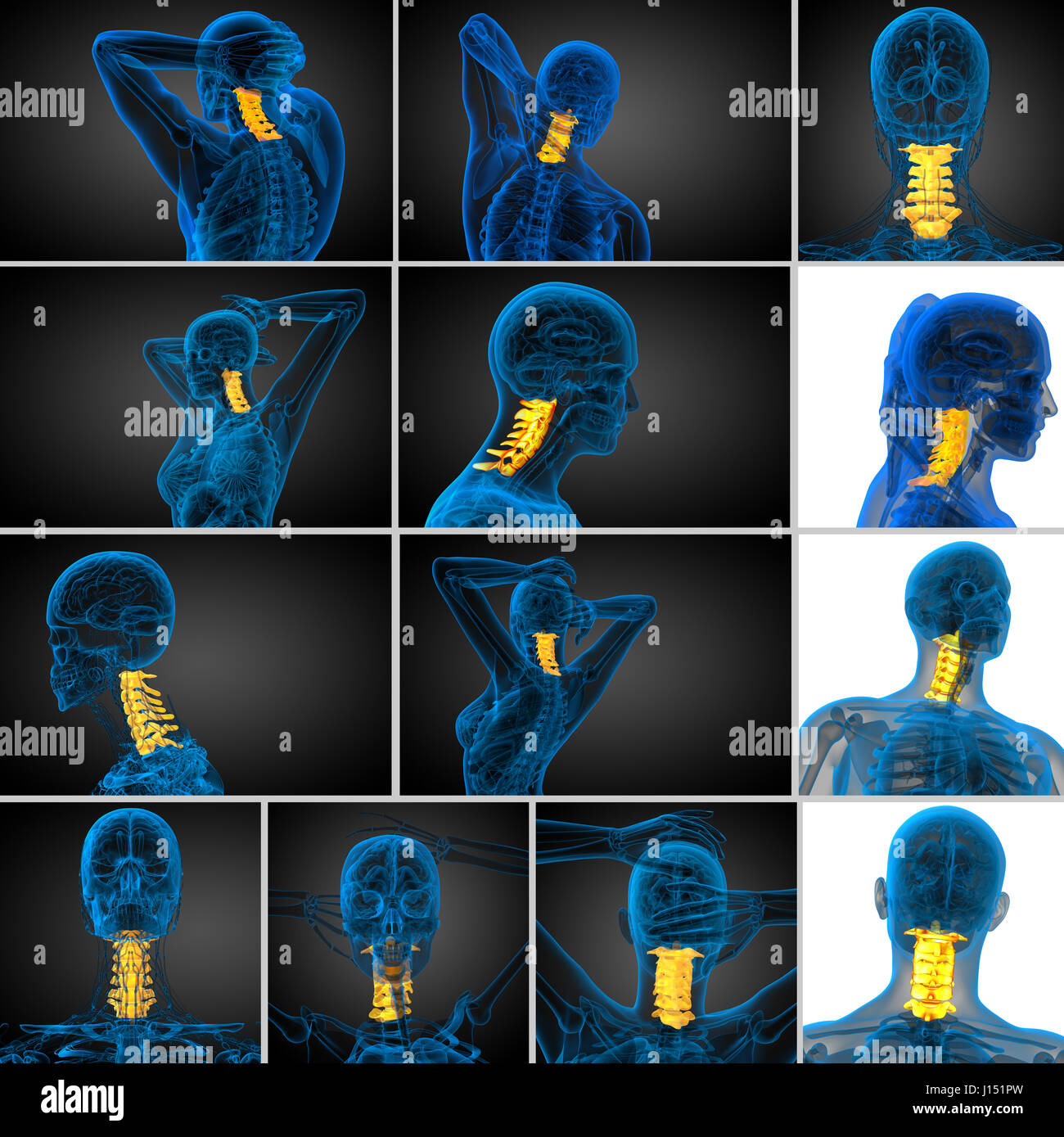 3d rendering medical illustration of the cervical spine Stock Photo - Alamy