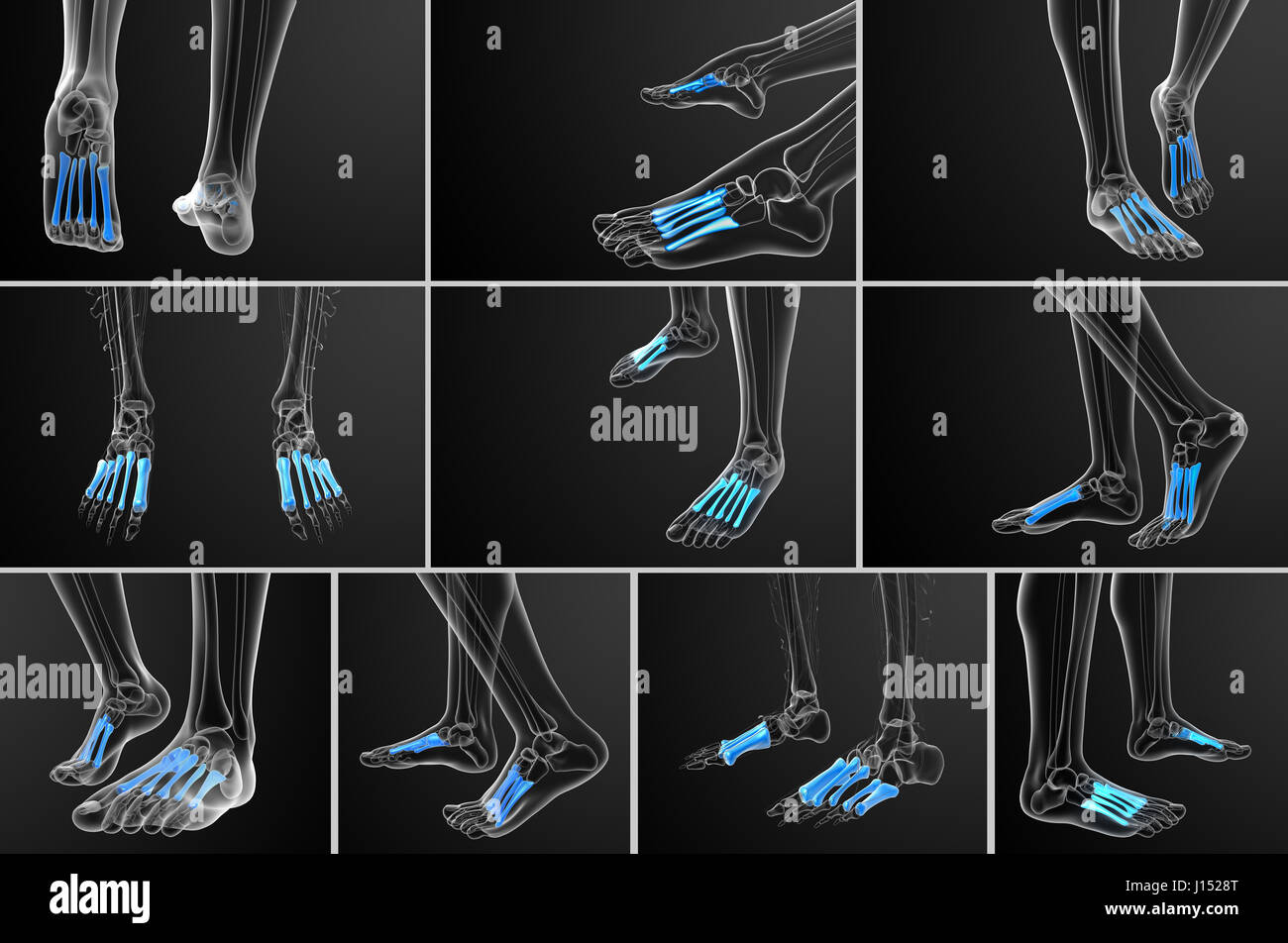 3d rendering medical illustration of the metatarsal bones Stock Photo ...