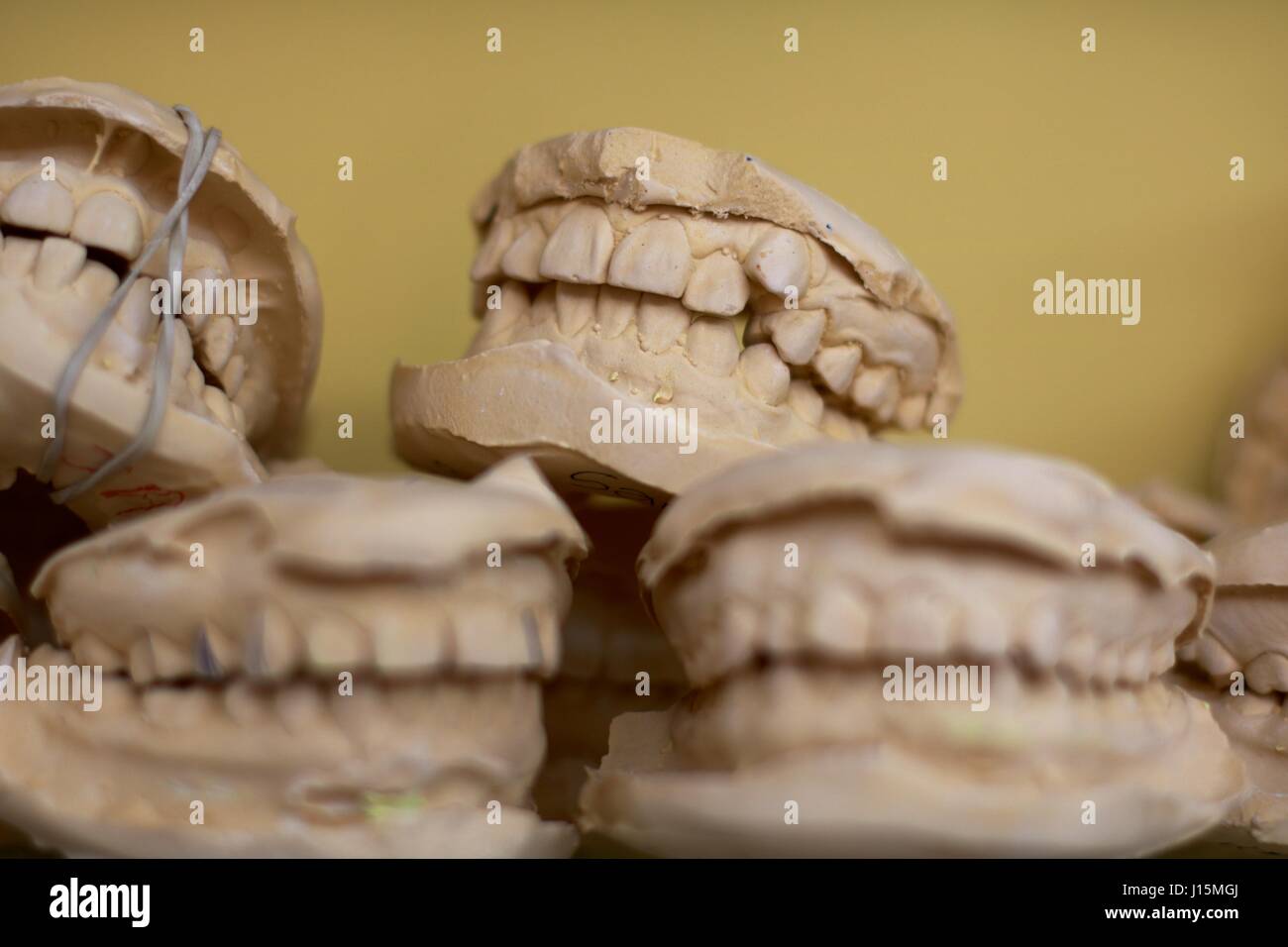 Teeth Mold Stock Photos & Teeth Mold Stock Images - Alamy