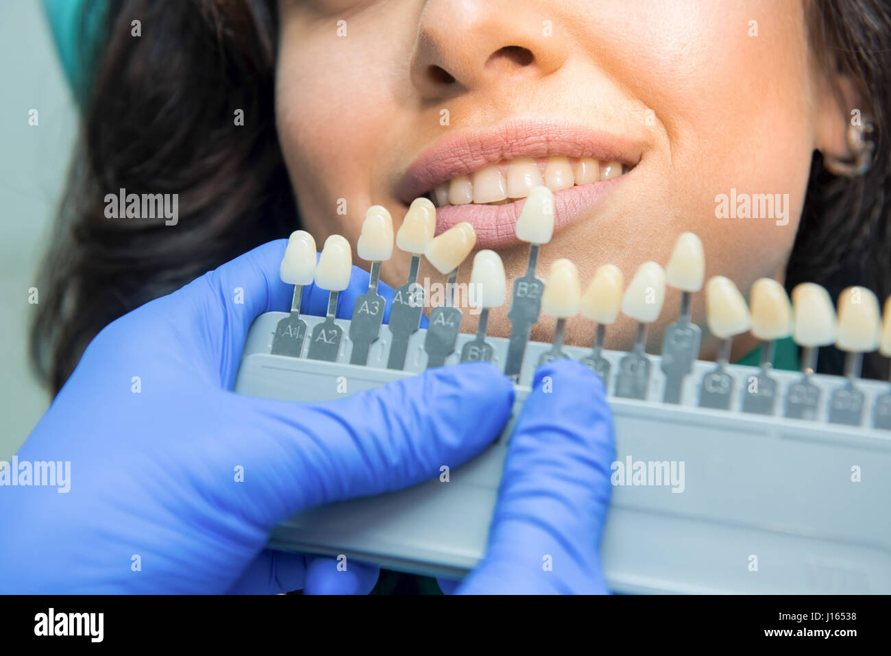 Tooth whitening chart. Smile of young woman Stock Photo - Alamy