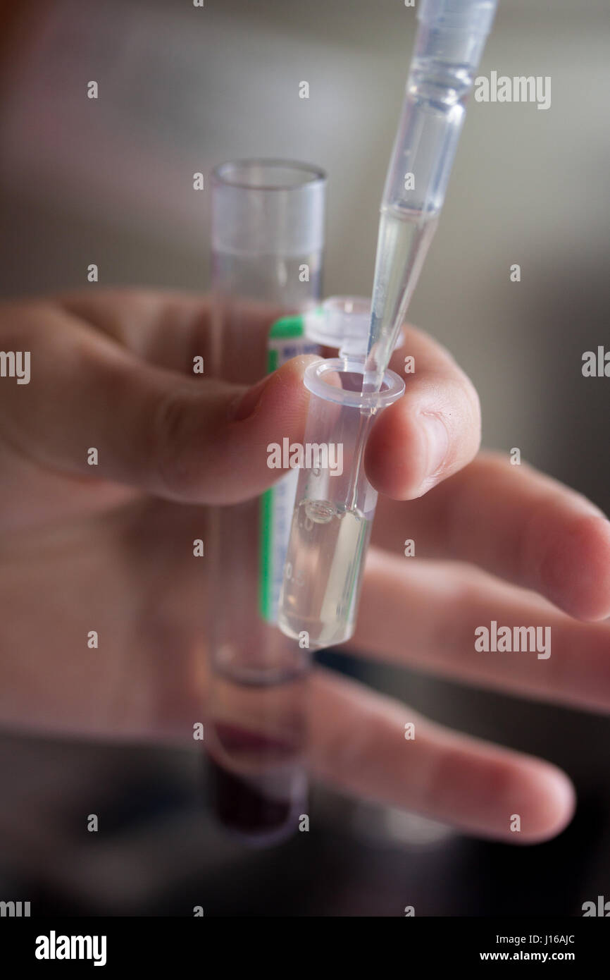 Researcher studying blood sample hi-res stock photography and images ...