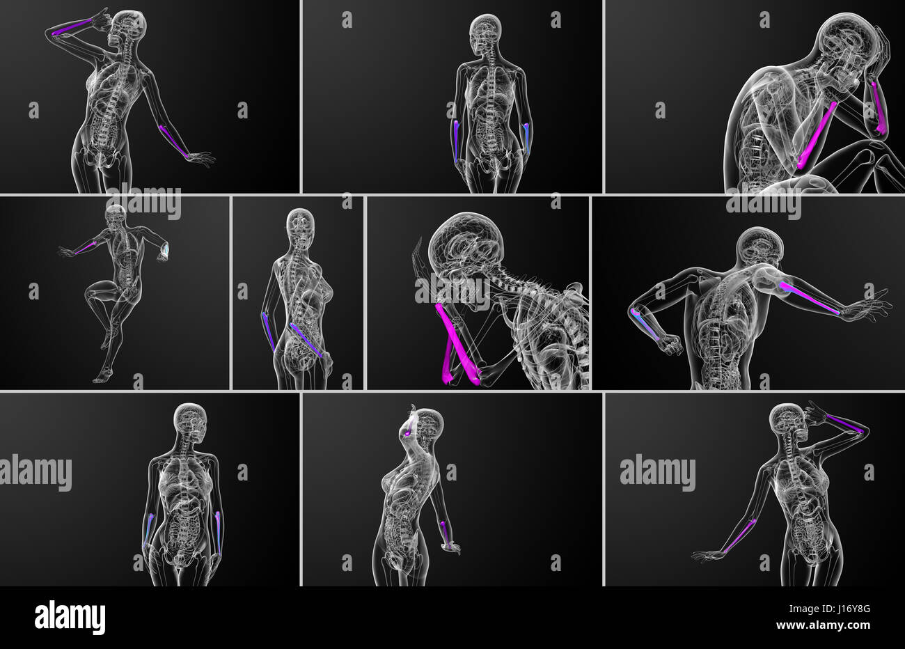 3d rendering medical illustration of the ulna bone Stock Photo - Alamy