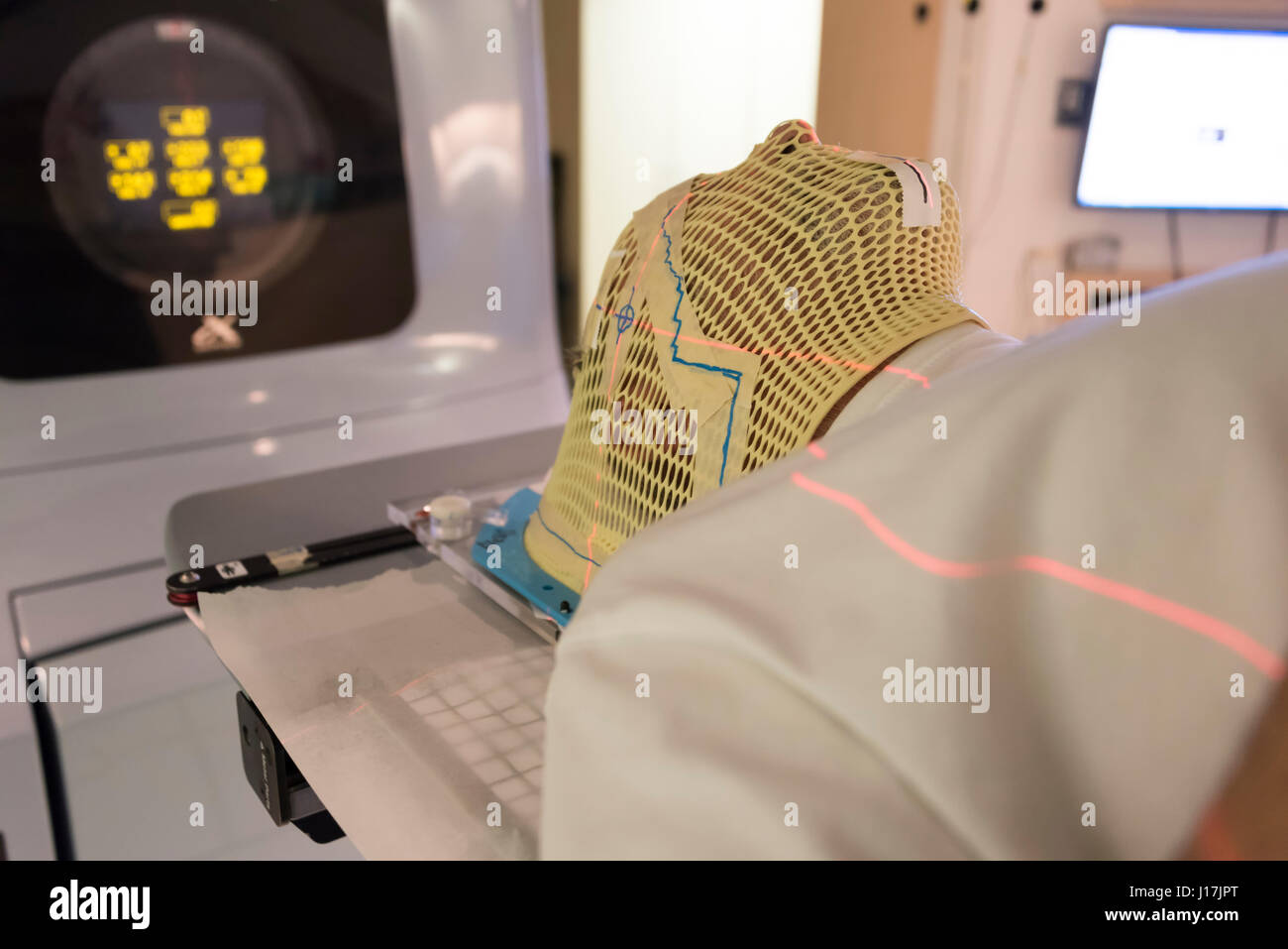 Patient Radiation therapy mask showing laser lines for targeting cancer ...