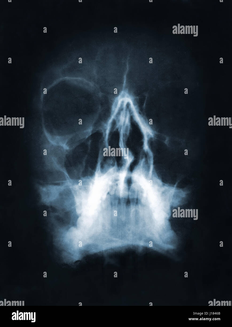 Front face skull x-ray image Stock Photo - Alamy