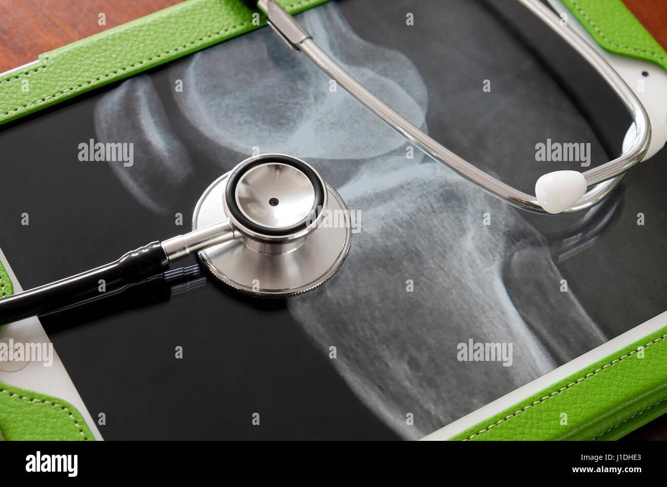 Computer x ray hi-res stock photography and images - Alamy
