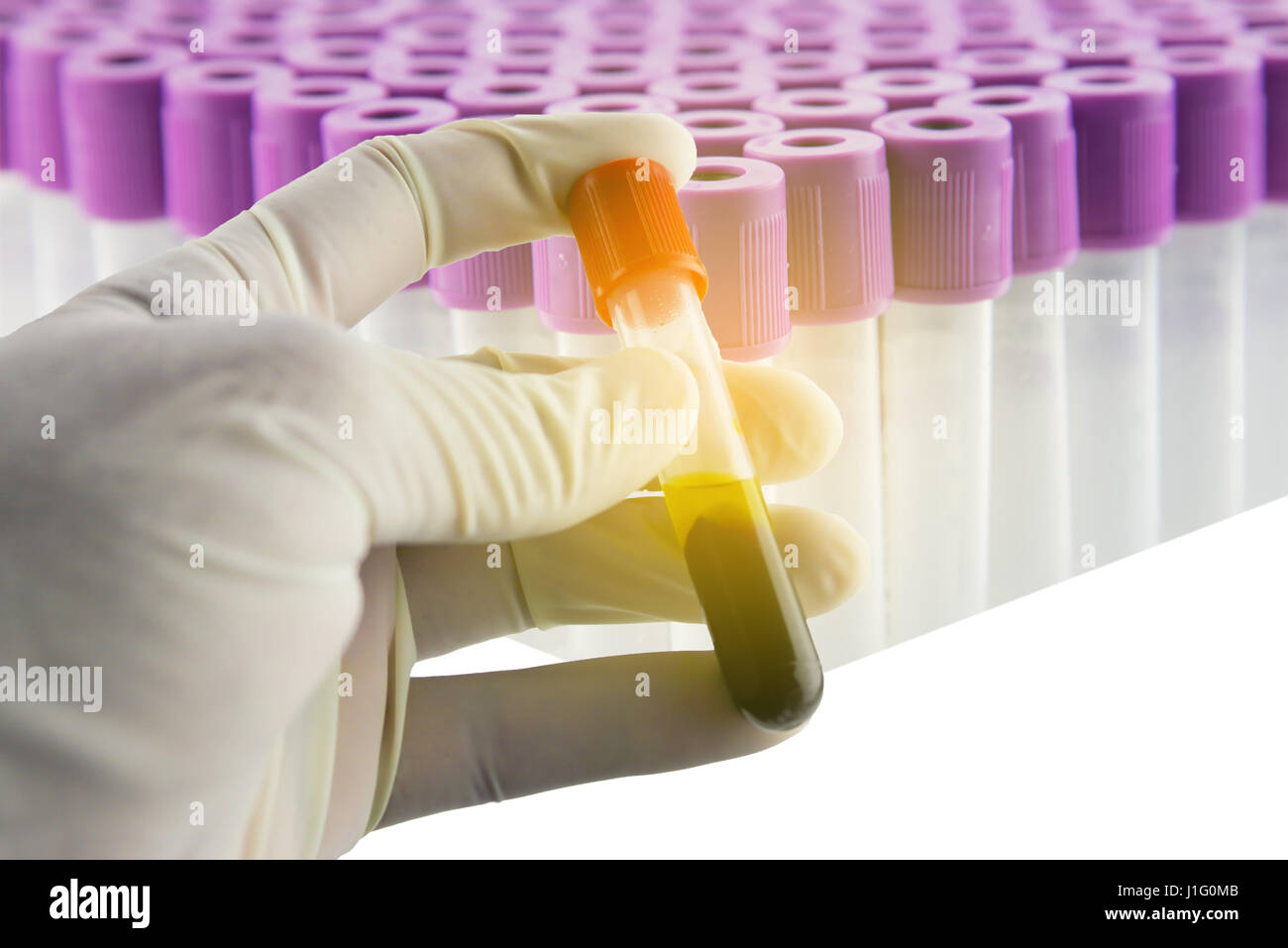 Edta tube hi-res stock photography and images - Alamy