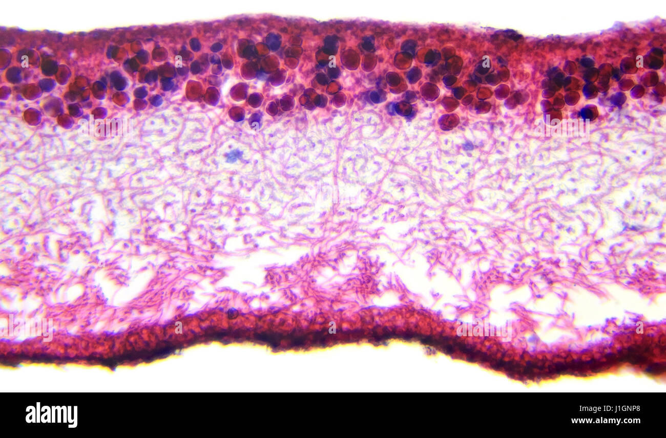 Lichens Under Microscope