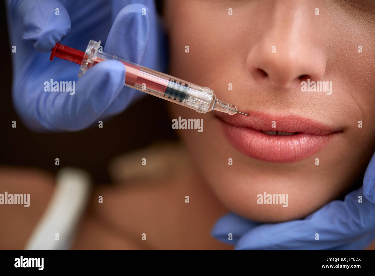 Botox lips hi-res stock photography and images - Alamy